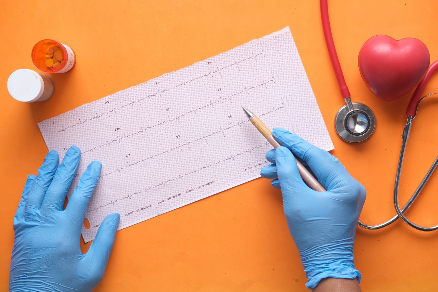 Telemetry Technicians vs. EKG Technicians