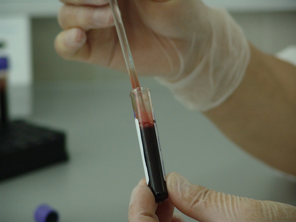 14 Pros and Cons of Being a Phlebotomist