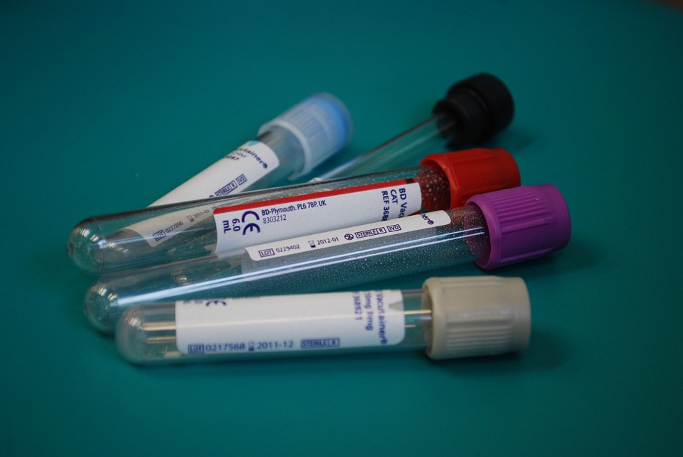 14 Pros and Cons of Being a Phlebotomist